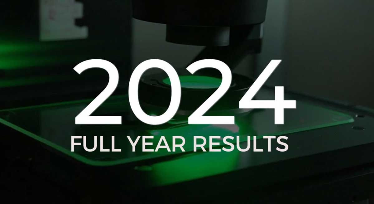 Press release – 2024 Financial Results | Valeo